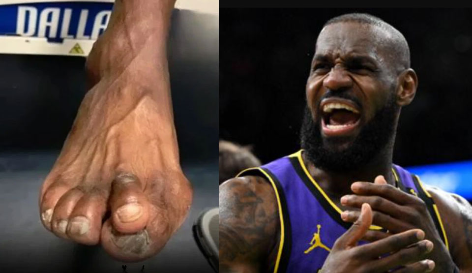 LeBron James y el deterioro de sus pies tras 20 años de básquet ...